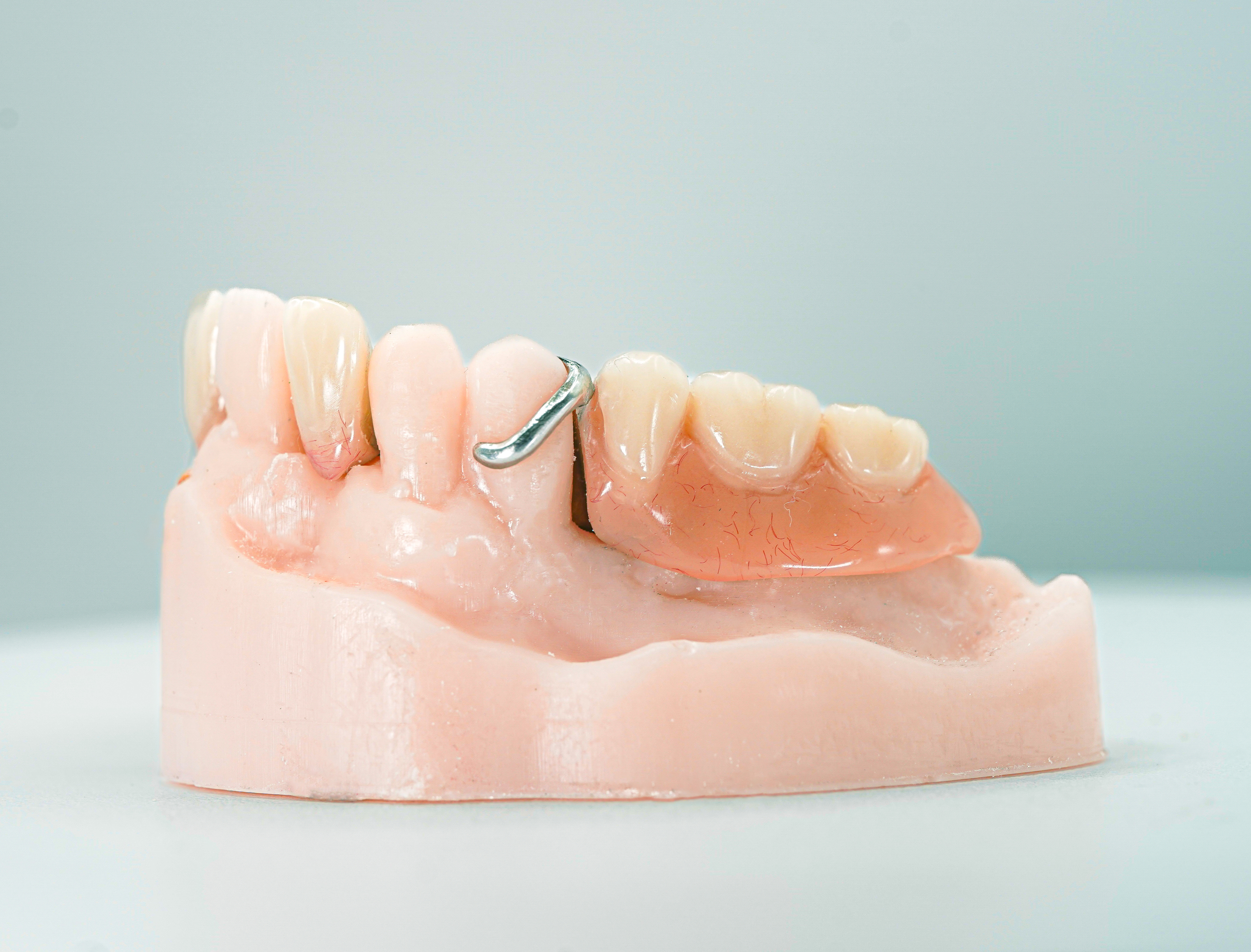 SLM Cobalt Chrome Partial Dentures